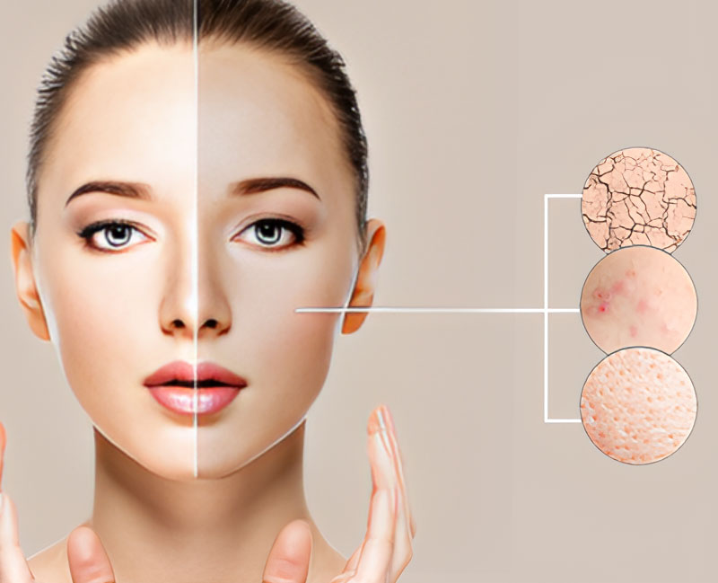 Juliette Armand Acne Therapy - Juliette Armand - The personal ...